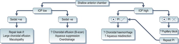 Shallow Anterior Chamber