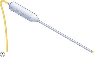 Endophotocoagulation