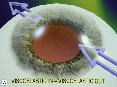 Endophotocoagulation