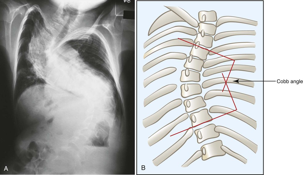 Clinical Manifestations and Assessment of Respiratory Disease