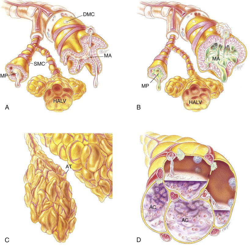 Clinical Manifestations and Assessment of Respiratory Disease