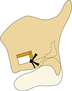 Cummings Otolaryngology