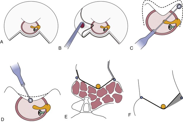 Cummings Otolaryngology