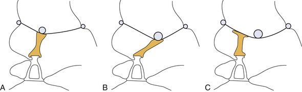 Cummings Otolaryngology