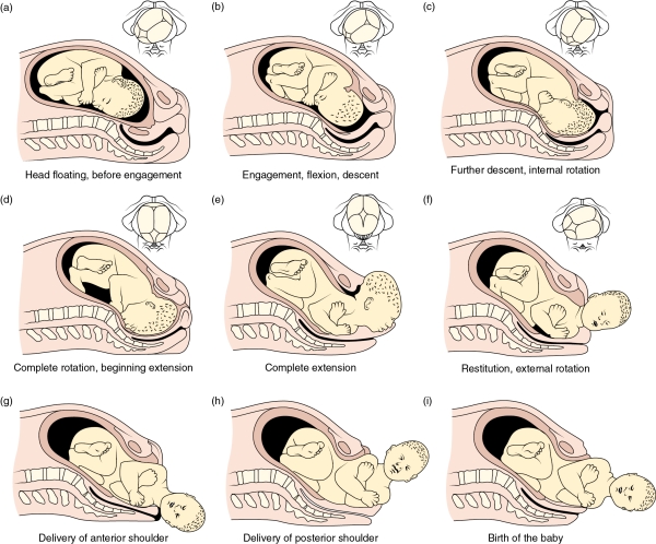 Obstetrics & Gynaecology : Prep Manual for Undergraduates