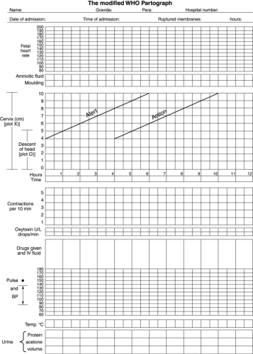 Obstetrics & Gynaecology : Prep Manual for Undergraduates