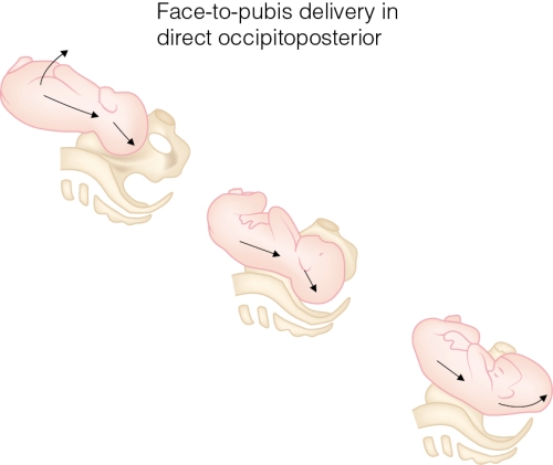 Obstetrics & Gynaecology : Prep Manual for Undergraduates