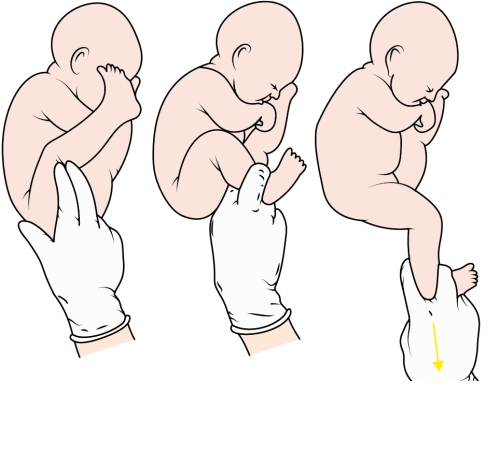 Obstetrics & Gynaecology : Prep Manual for Undergraduates