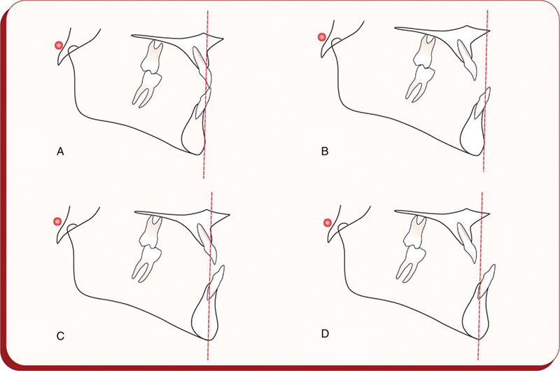 Clinical Orthodontics