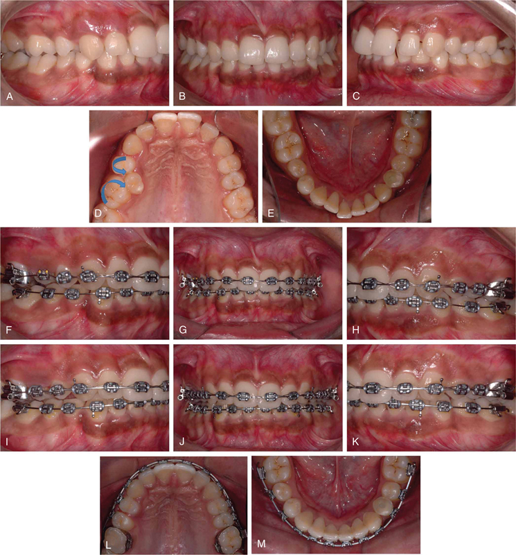 Clinical Orthodontics