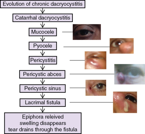 Clinical Examination in Ophthalmology