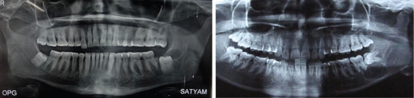 Shafer’s Textbook of Oral Pathology