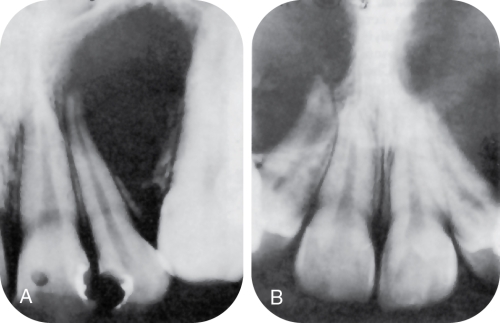Shafer’s Textbook of Oral Pathology