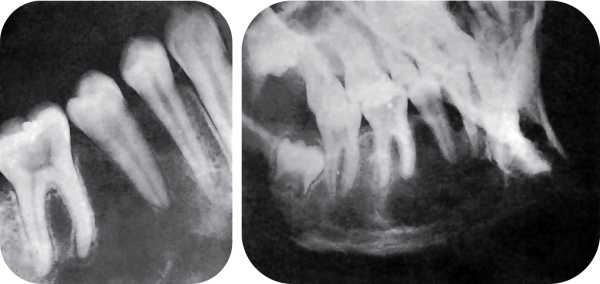 Shafer’s Textbook of Oral Pathology