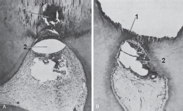 Shafer’s Textbook of Oral Pathology