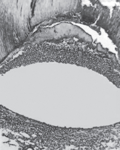 Shafer’s Textbook of Oral Pathology