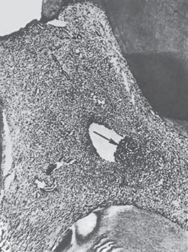 Shafer’s Textbook of Oral Pathology