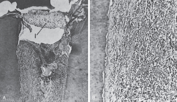 Shafer’s Textbook of Oral Pathology