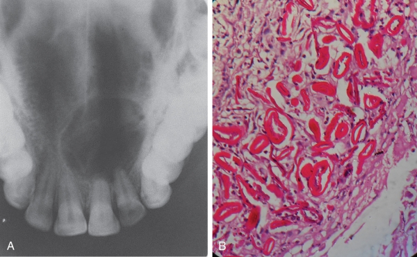 Shafer’s Textbook of Oral Pathology