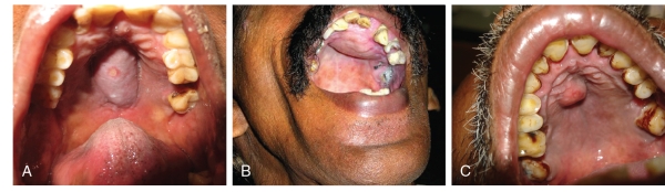 Shafer’s Textbook of Oral Pathology