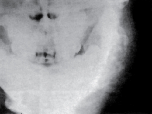 Shafer’s Textbook of Oral Pathology