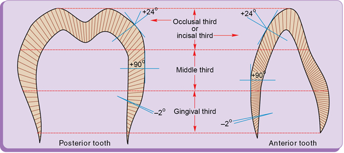 Preclinical Manual of Conservative Dentistry and Endodontics