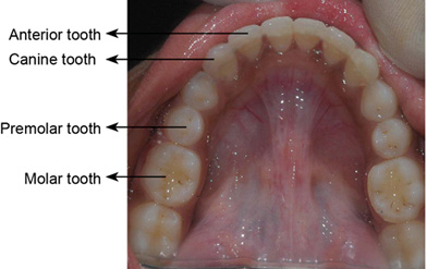 Preclinical Manual of Conservative Dentistry and Endodontics