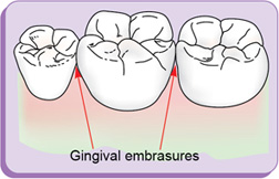 Preclinical Manual of Conservative Dentistry and Endodontics