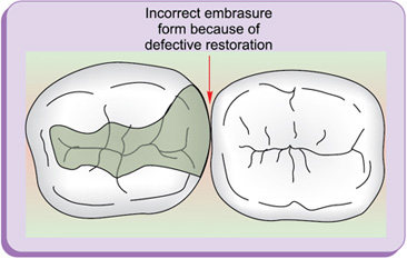 Preclinical Manual of Conservative Dentistry and Endodontics