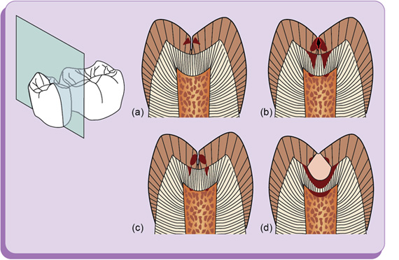 Preclinical Manual of Conservative Dentistry and Endodontics