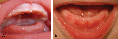 Textbook of Orthodontics