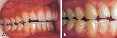 Textbook of Orthodontics