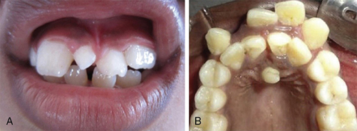 Textbook of Orthodontics