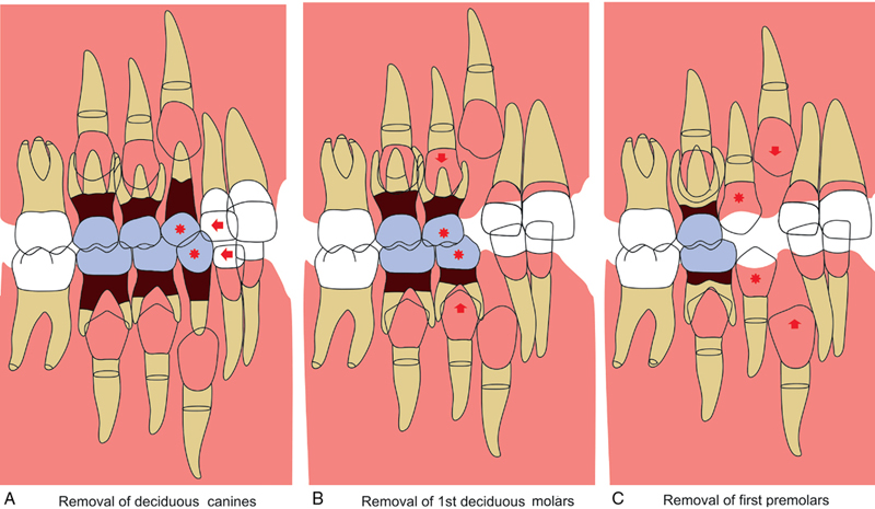 Textbook of Orthodontics