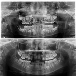 Textbook of Orthodontics