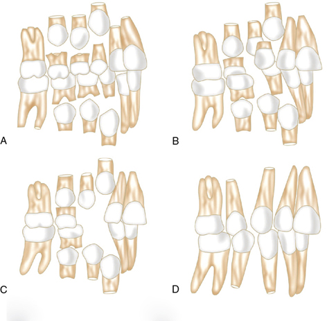 Textbook of Orthodontics