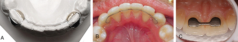 Textbook of Orthodontics