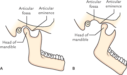 Chapter 10: Infratemporal Fossa, Temporomandibular Joint, and Pterygo ...