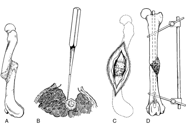 Brinker, Piermattei, and Flo's Handbook of Small Animal Orthopedics and ...