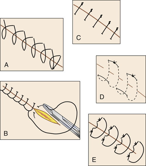 Berry & Kohn’s Operating Room Technique