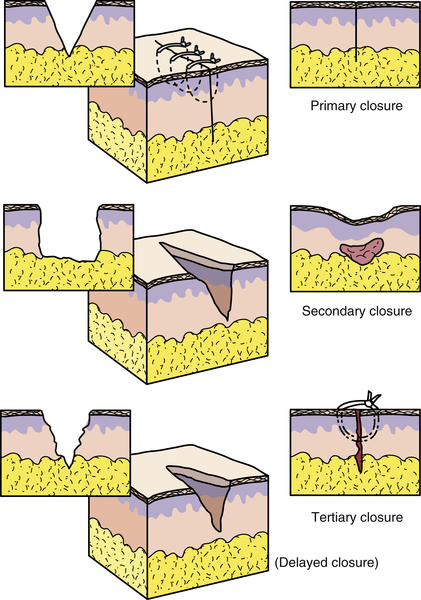 Berry & Kohn’s Operating Room Technique