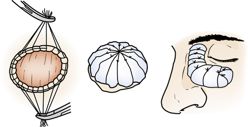 Berry & Kohn’s Operating Room Technique