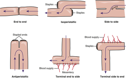 Berry & Kohn’s Operating Room Technique