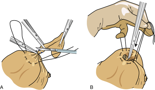 Berry & Kohn’s Operating Room Technique