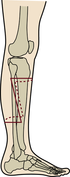 Berry & Kohn’s Operating Room Technique