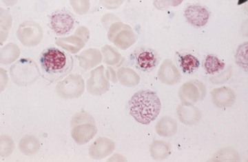 Goldman-Cecil Medicine