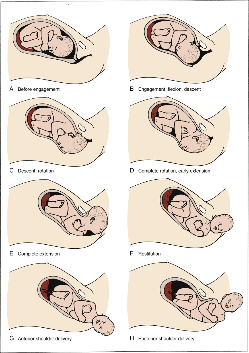 Obstetrics