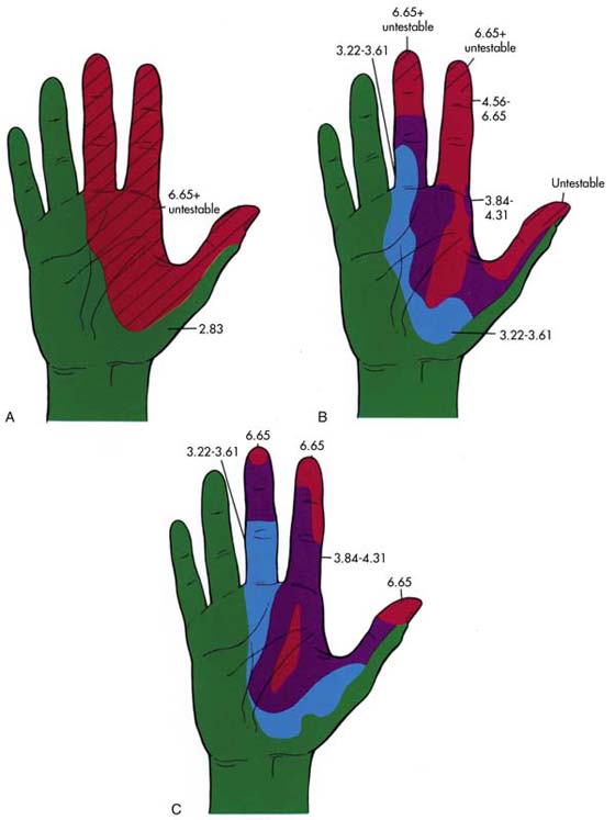 Rehabilitation of the Hand and Upper Extremity
